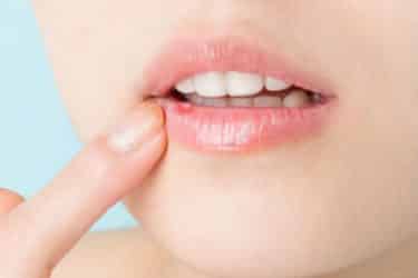 Afta - 10 principais causas do problema e como tratar a afta