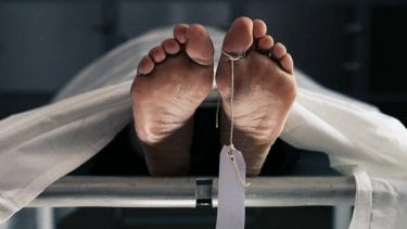 Autópsia, o que é? - Por que e como é feita e a reconstituição do corpo