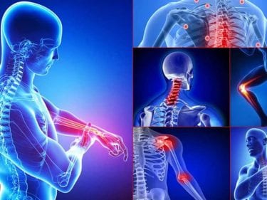 Reumatismo - O que é, principais causas e tratamentos indicados