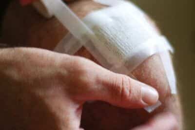 Machucados - Causas, tipos e o que fazer quando acontece